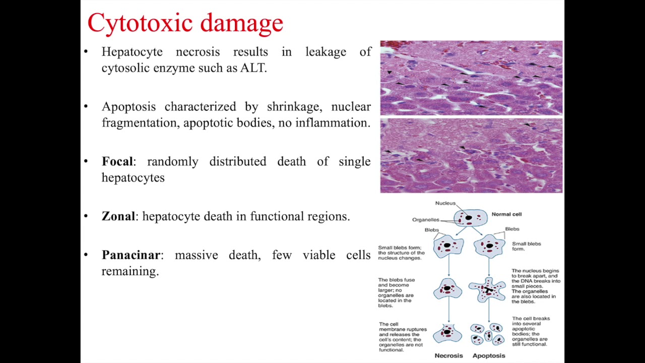 1. Target Organ Toxicity Liver - YouTube