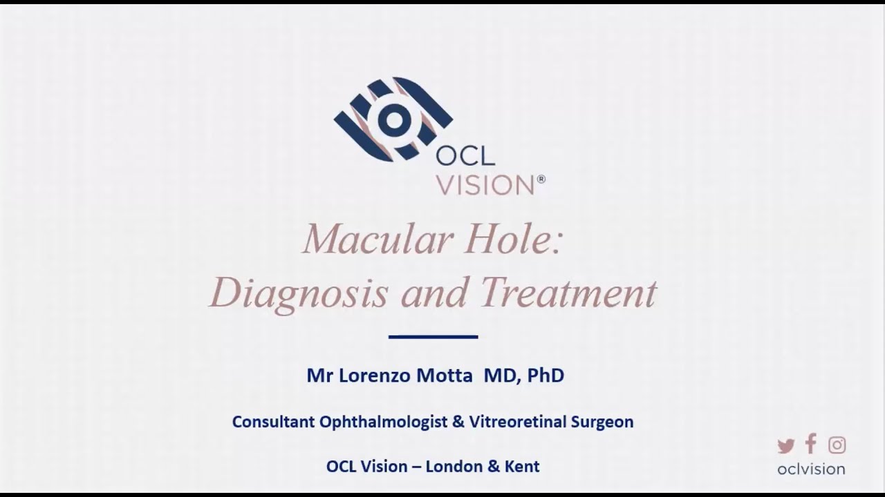 OCL Vision Webinar - Macular Hole: Diagnosis & Treatment - YouTube