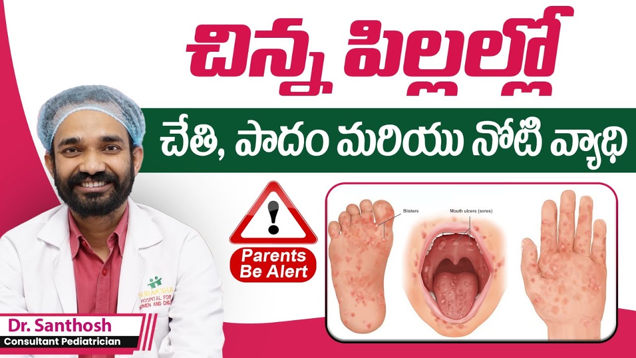 How to Cure Hand Foot and Mouth Disease || HFMD Home Remedies for ...