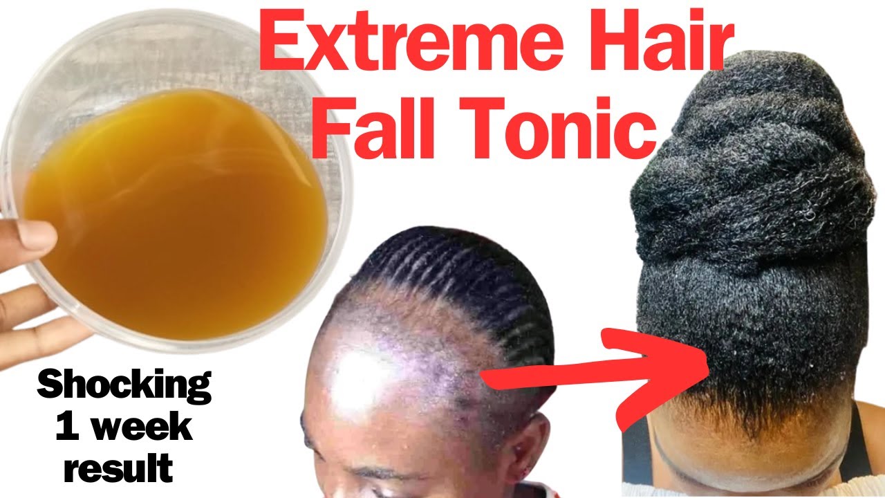 Stop Hair Fall 👉 Best Effective Hair Fall Control Hair Tonic. Extreme ...