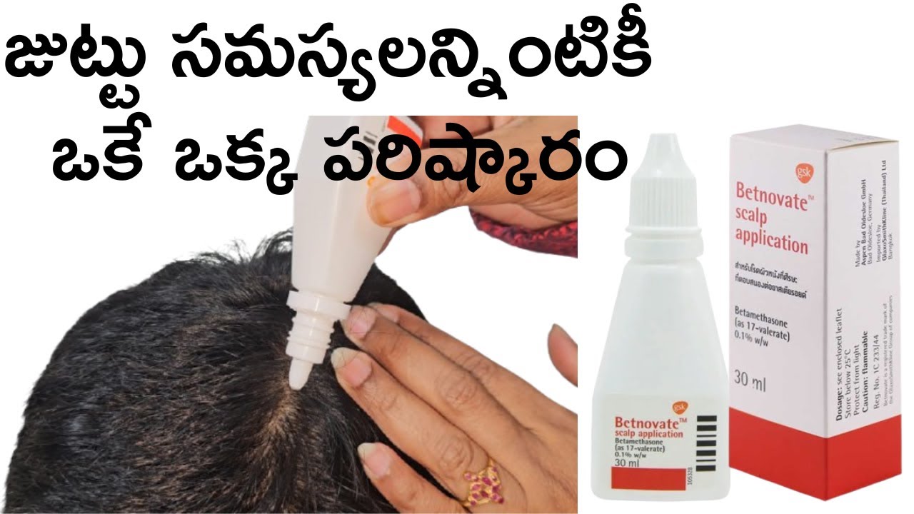 Betnovate Scalp application for extreme dandroff, Inflammation, Redness ...