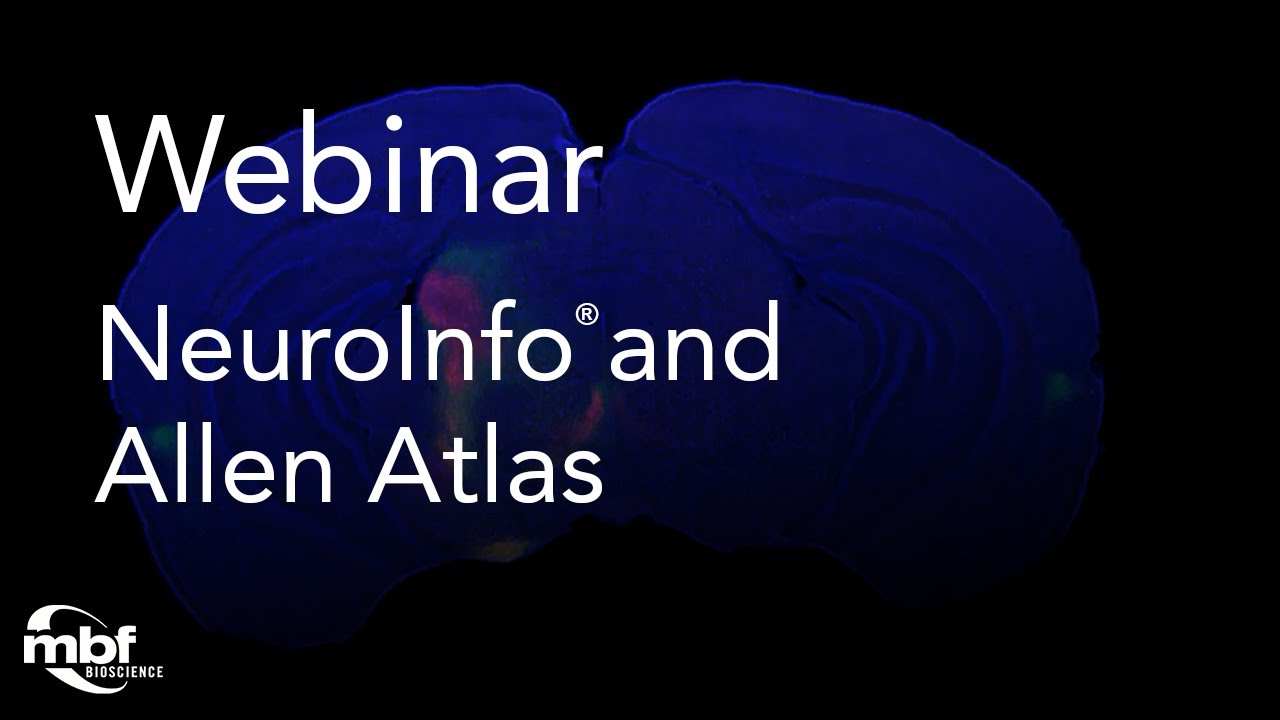 Webinar: Reconstructing Whole Mouse Brain Volume from Serial Sections ...