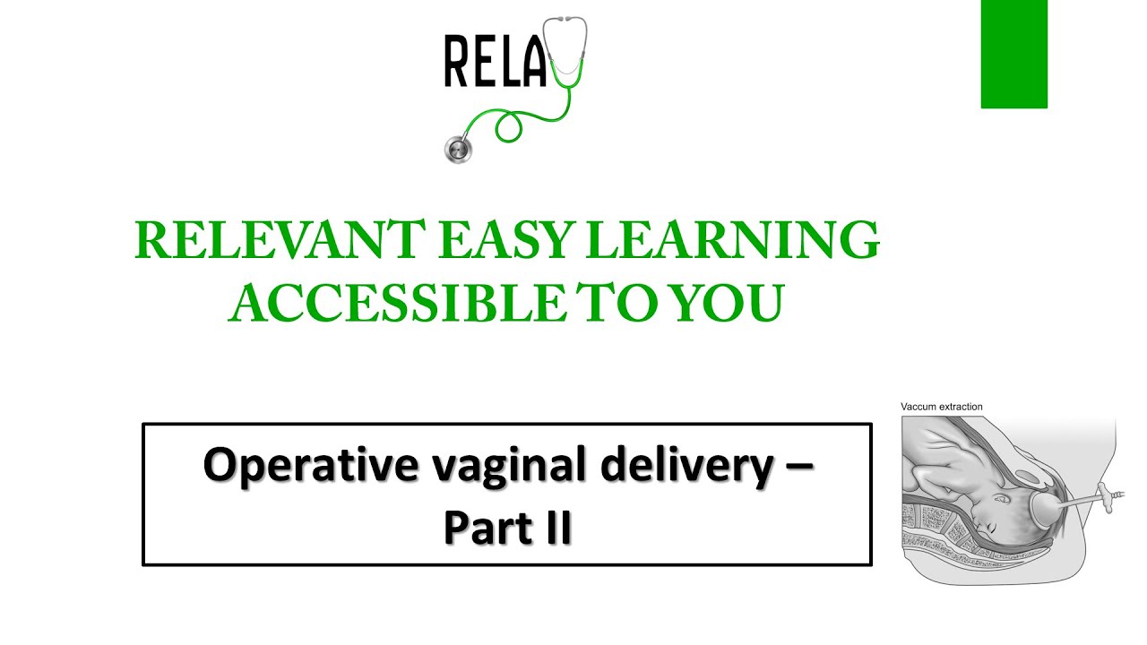 Operative vaginal delivery – Part II - YouTube