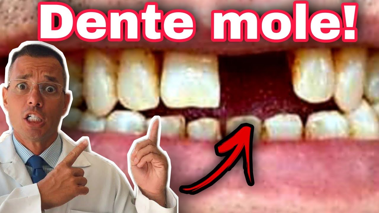 Por que os DENTES ficam MOLES? Como deixá-los MAIS FORTES? - YouTube