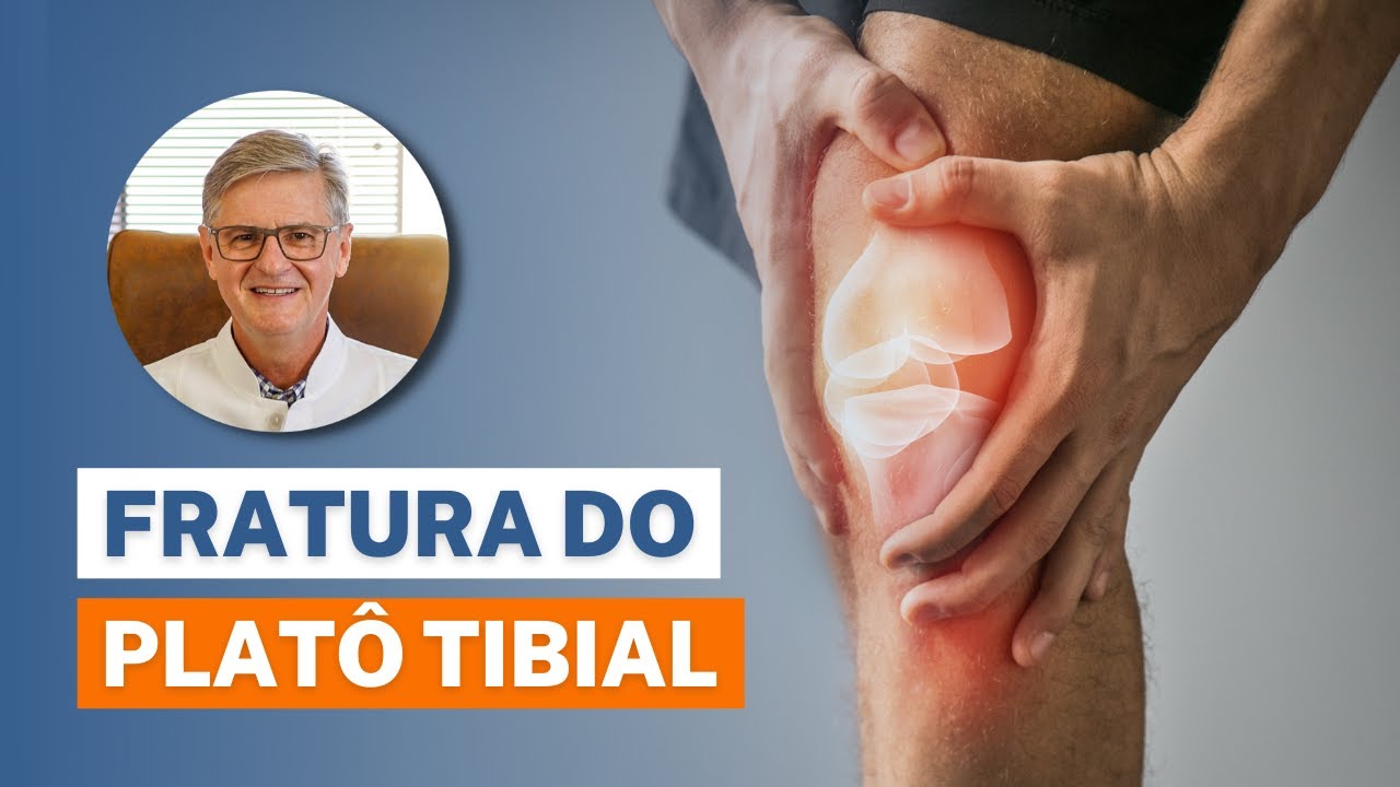 Fratura de platô tibial (Sintomas, Diagnósticos e Tratamentos) - YouTube