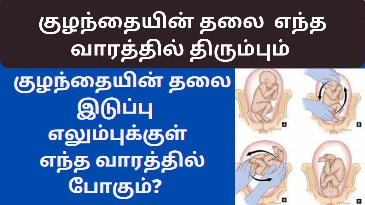 symptoms of head down position of baby | Symptoms of head down position ...