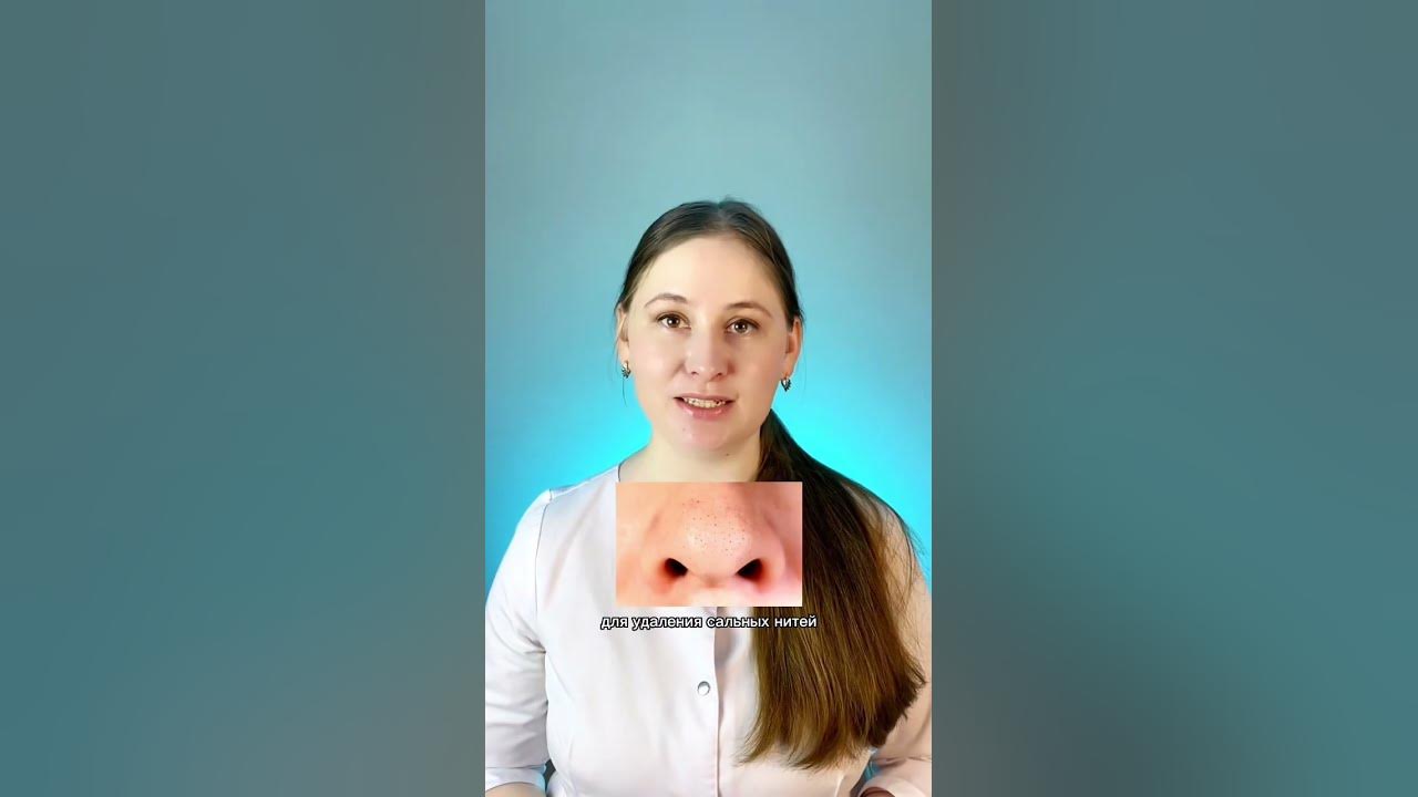 Черные точки, сальные нити - YouTube