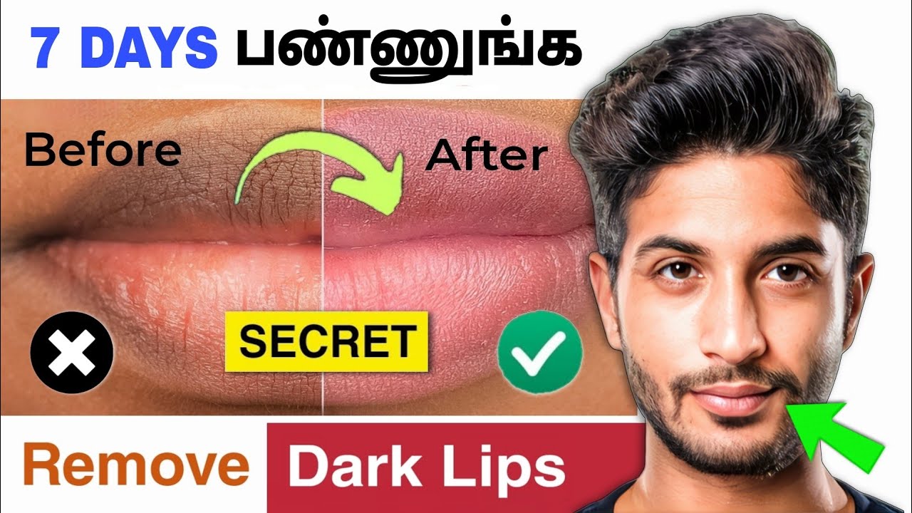 10 Min. Dark Lips Removal Home Remedy🔥அழகான உதடைப் பெற EASY வழிகள் ...