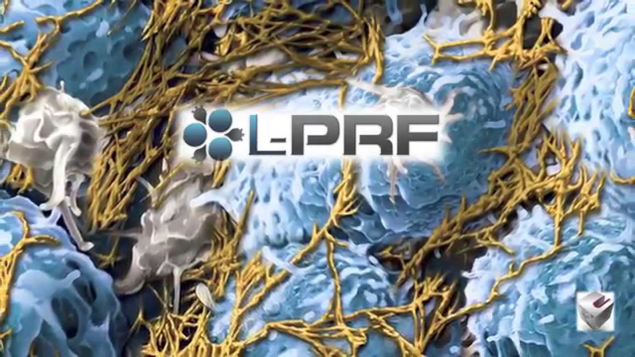 Why L-PRF (Leukocyte-Platelet Rich Fibrin)? - YouTube