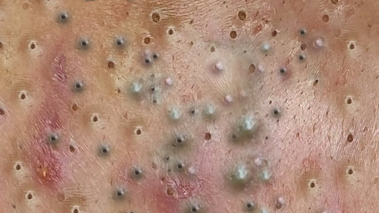 A Lovely day with Windy Spa 05 #17 - YouTube