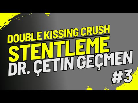 Double Kissing Crush Stentleme - YouTube