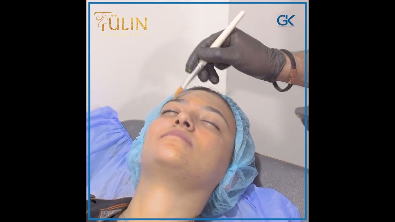 Dr. Ahmed Ashraf - Cimel Cold peel Session ^IG | د.أحمد أشرف - جلسة ...
