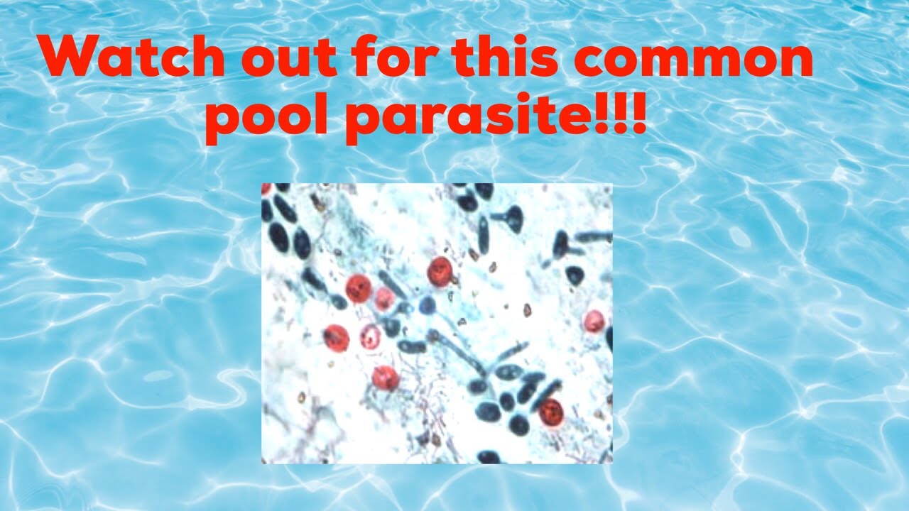 WATCH THIS VIDEO BEFORE YOU GO SWIMMING AGAIN! | How To Protect ...