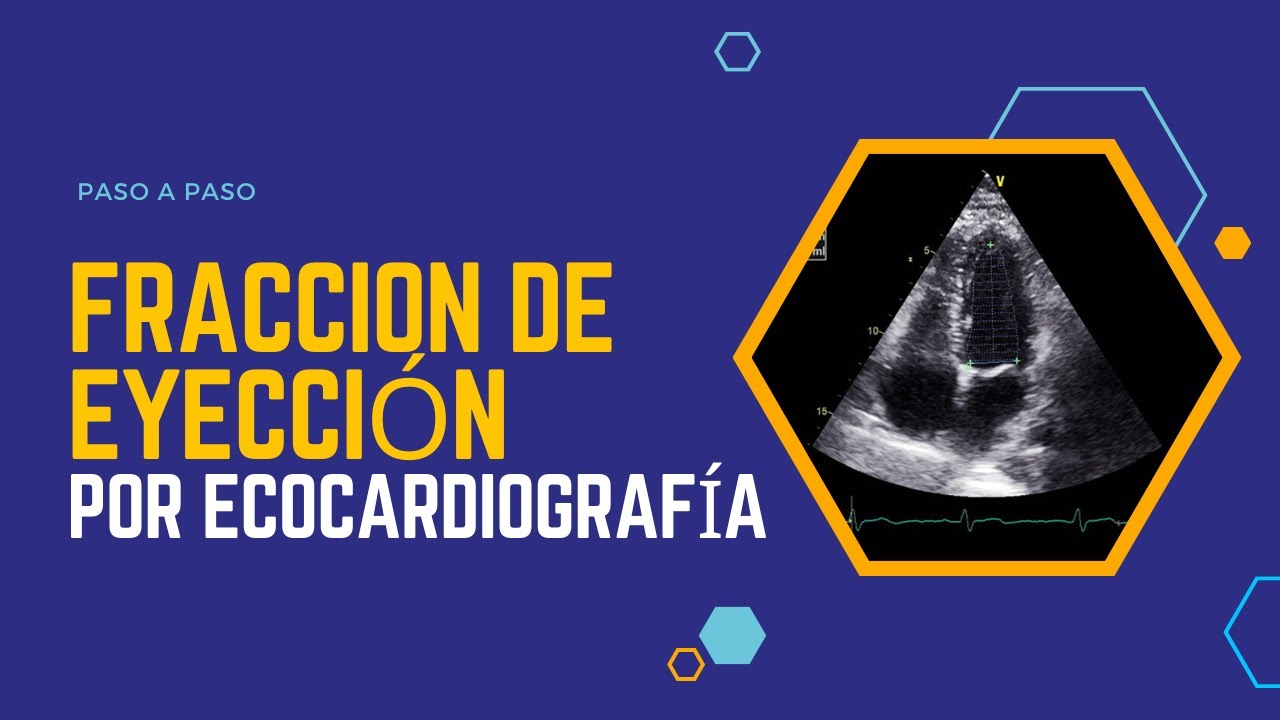 FRACCIÓN DE EYECCIÓN (FEVI) por ecocardiografía. PASO A PASO. - YouTube