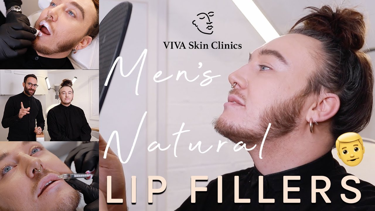Men's Natural-Looking Lip Fillers London | VIVA Skin Clinics - YouTube