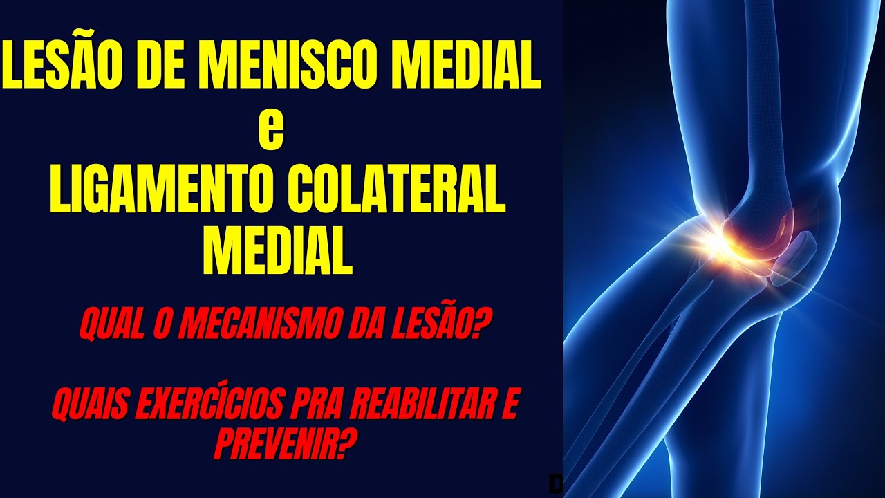 DOR NO JOELHO - Lesão de Menisco Medial e Ligamento Colateral Medial ...