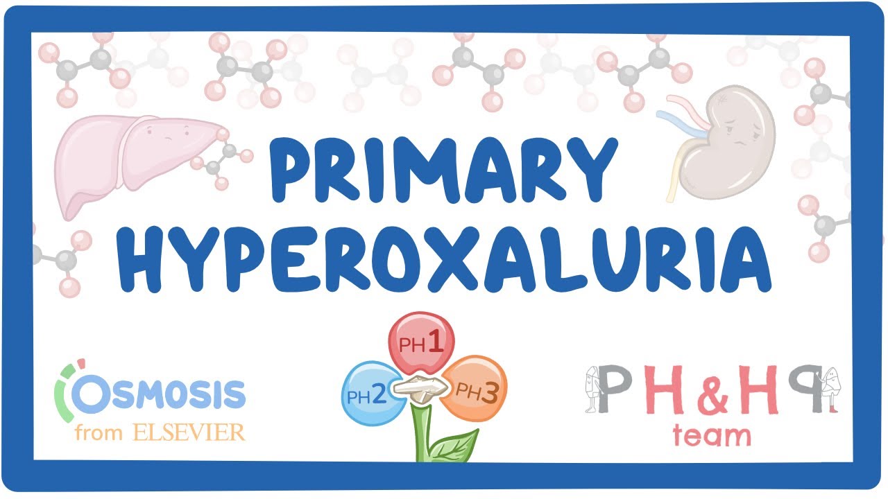Primary hyperoxalurias - causes, symptoms, diagnosis, treatment ...