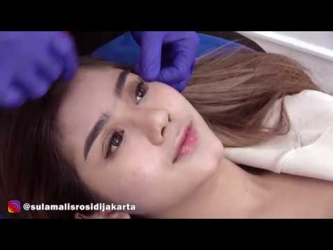 GHEAYOUBI RETOUCH SULAM ALIS