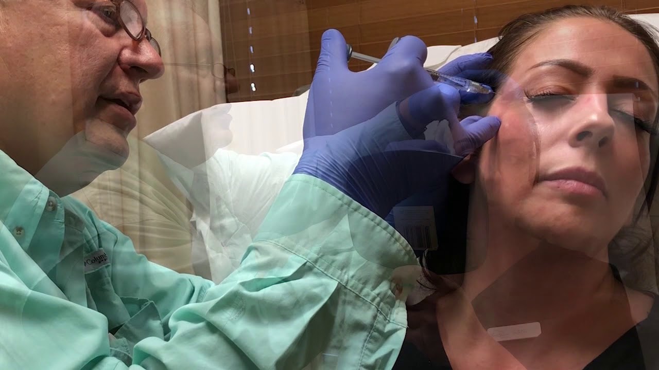 Filler injections in the temples for a younger look using Juvederm ...