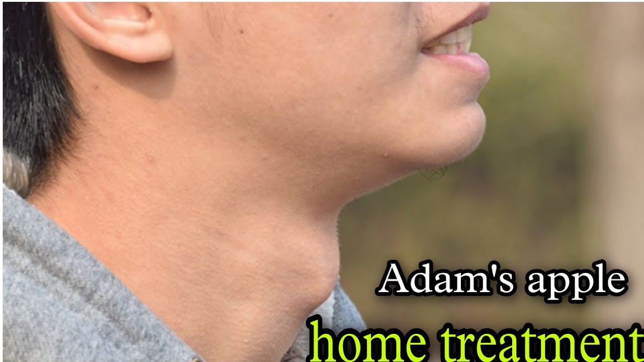 Adam's apple को अंदर कैसे करे ! टेंटुये को अंदर करें केवल 1 दिन मैं ...