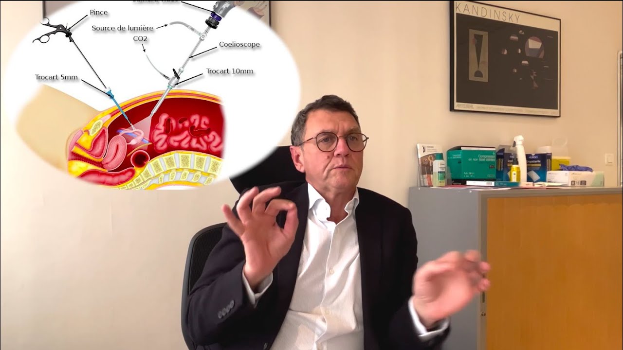 Mars Bleu : les traitements du cancer du colon - Interview du Dr ...