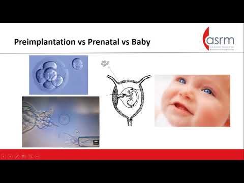 Ethik-Webinar: Transfer abnormaler Embryonen nach einer Präimplantationsdiagnostik