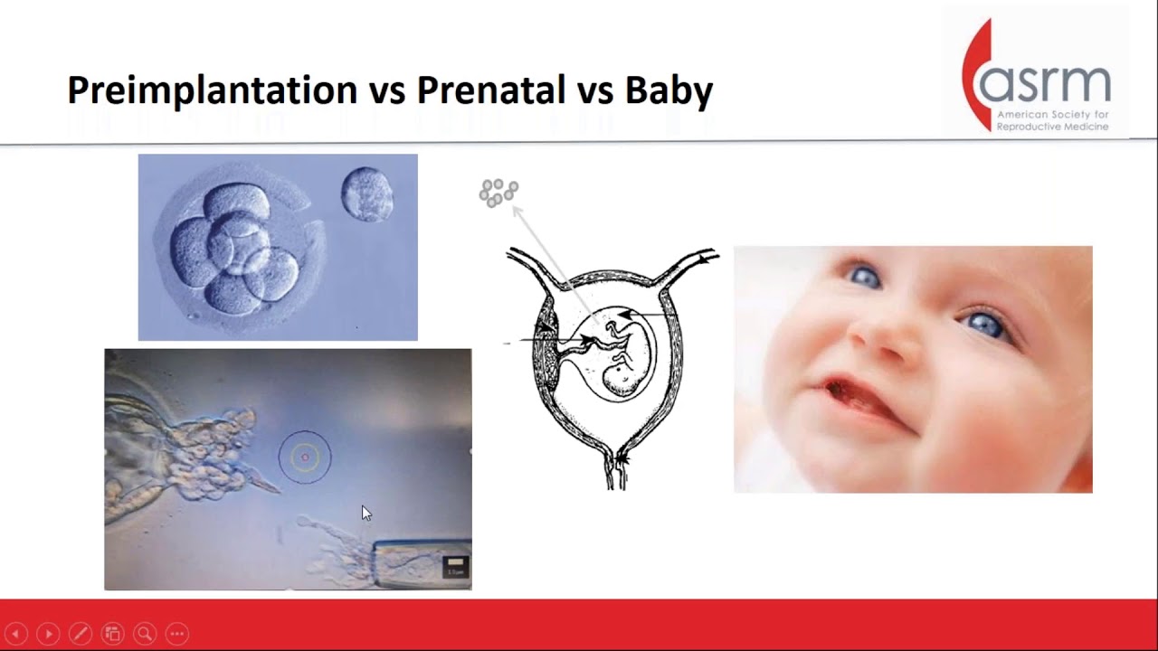 Ethics Webinar Transferring Abnormal Embryos After Preimplantation