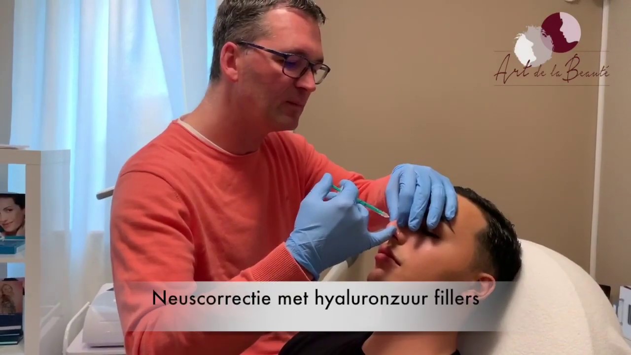 Neuscorrectie met fillers bij man - Art de la Beauté | Dokter Jean-Paul ...