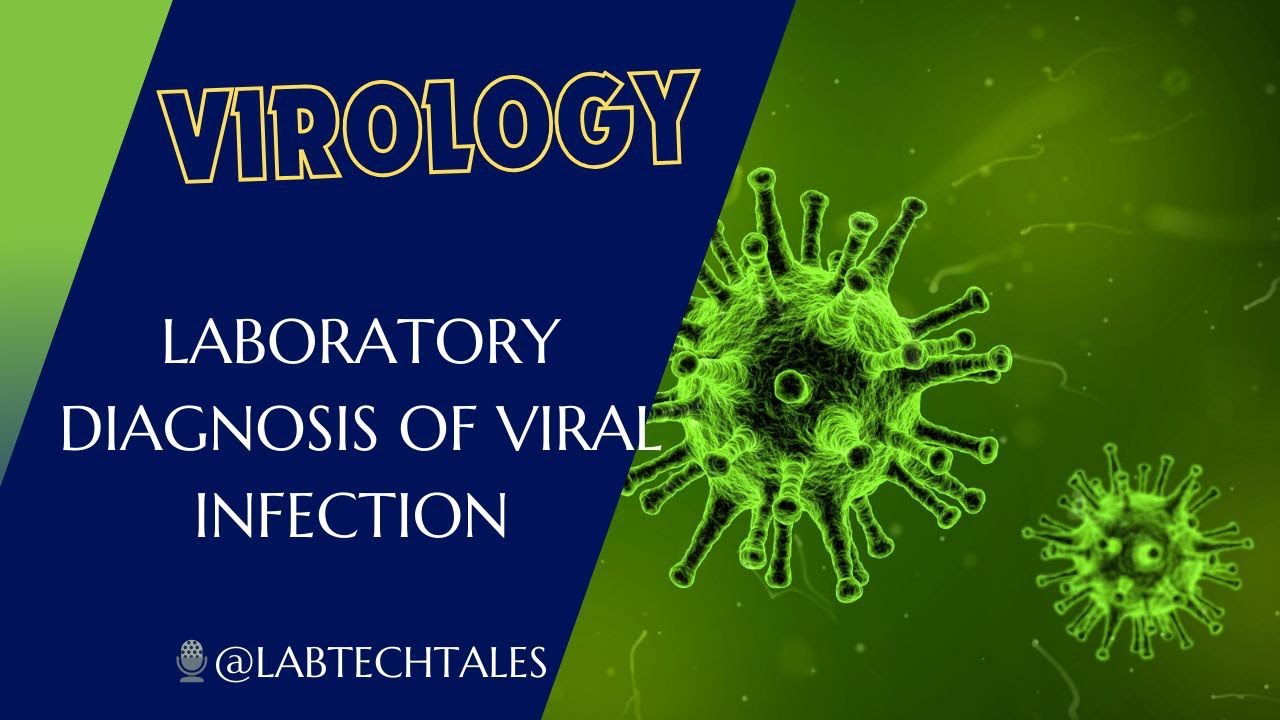 Laboratory diagnosis of viral infection - YouTube