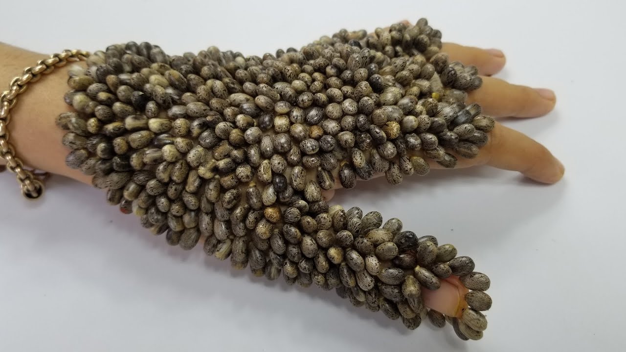 Remove millions ticks on hand - YouTube