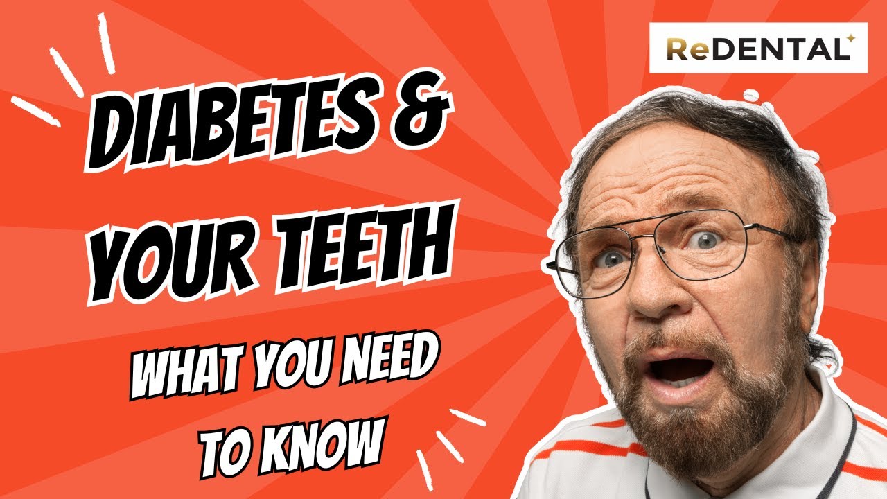 How Does Diabetes Affect Your Teeth? Expert Oral Health Advice by ...