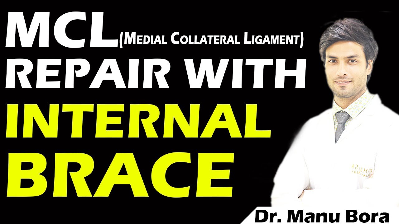 MCL (Medial Collateral Ligament) Repair With Internal Brace. // Dr Manu ...