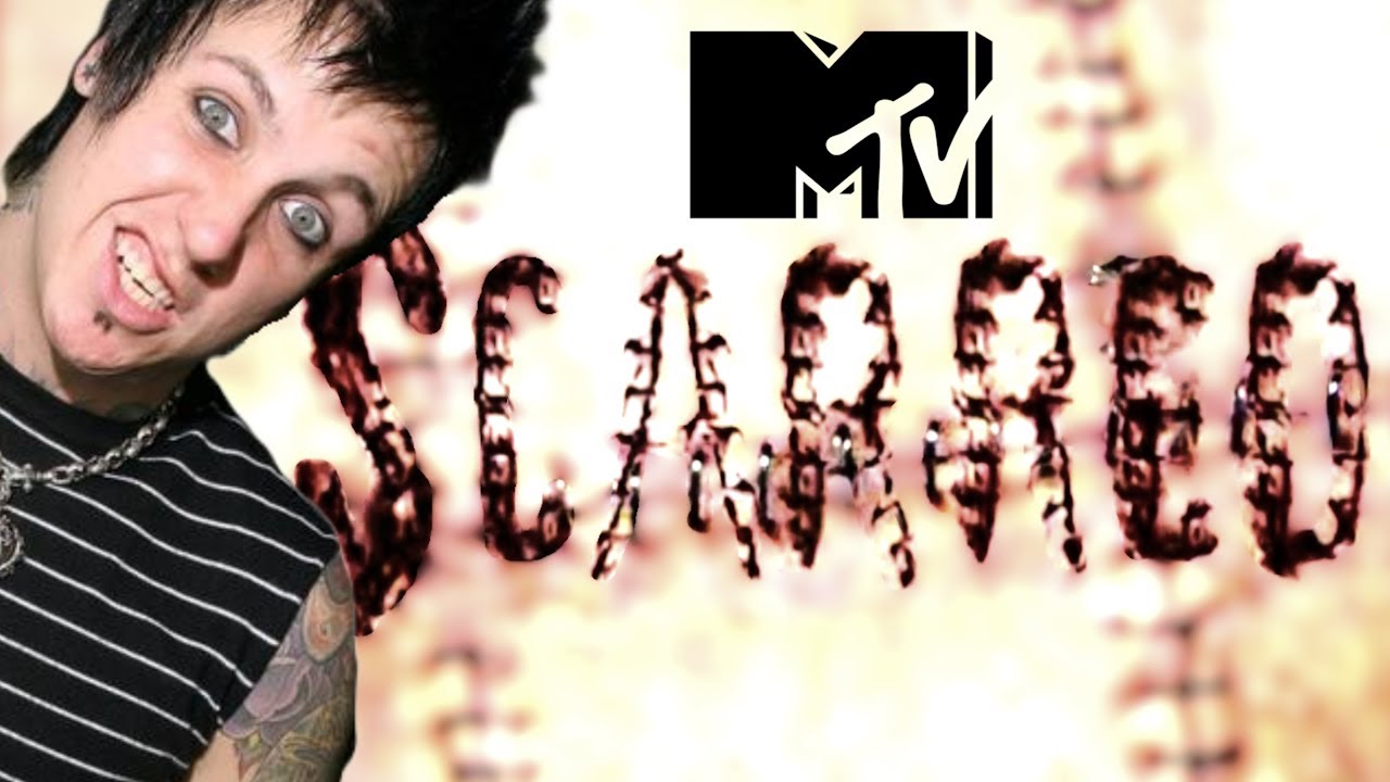 What Happened to Scarred MTV Show - YouTube