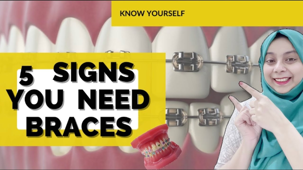 DO YOU NEED BRACES OR NOT? |KNOW YOURSELF| - YouTube