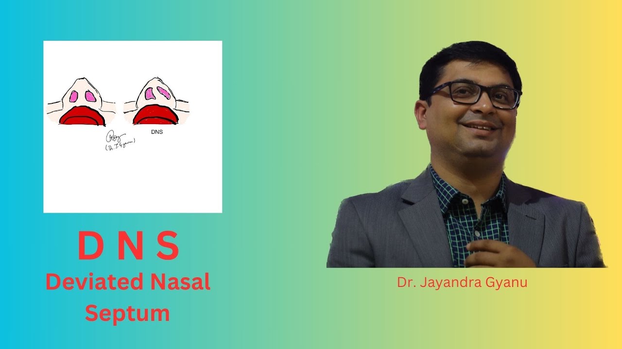 DNS ( Deviated Nasal Septum) - YouTube