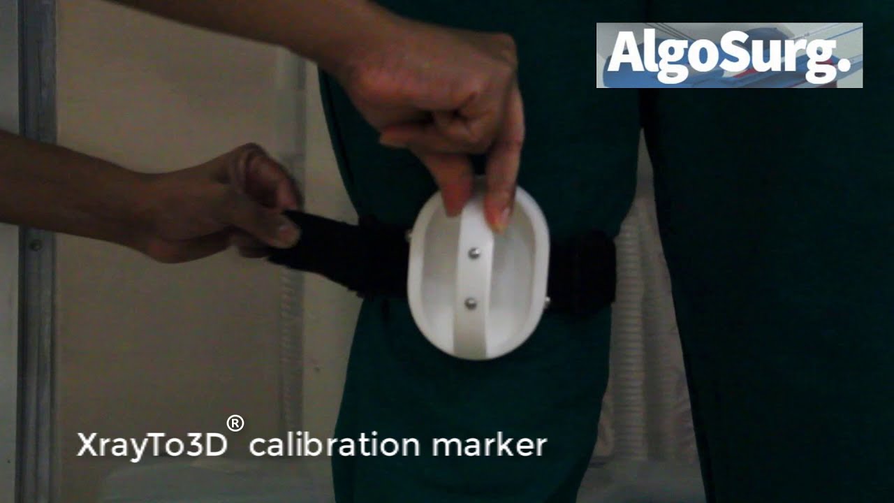XrayTo3D Calibration Marker Protocol - YouTube