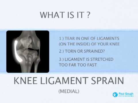 Knee Ligament Sprain - YouTube