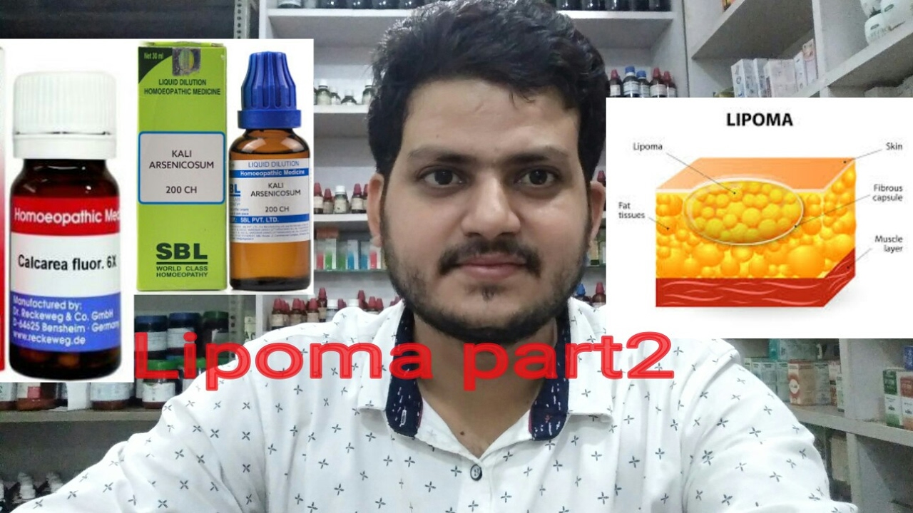 lipoma!Homeopathic medicine for lipoma?? part 2 - YouTube