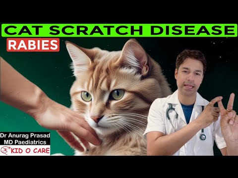 Cat Scratch Disease क्या है | Rabies Vaccine and Tetanus Toxoid in Cat Bite by Dr Anurag Prasad