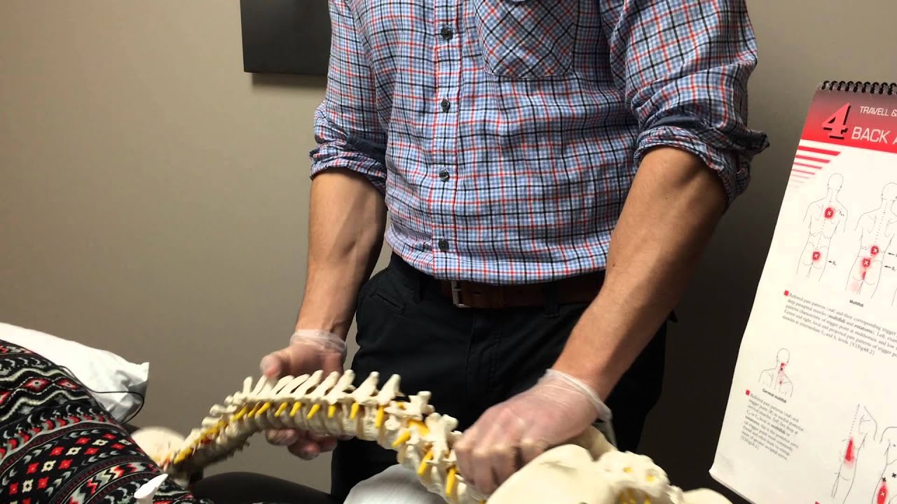 Trigger Point Dry Needling- Low Back - YouTube