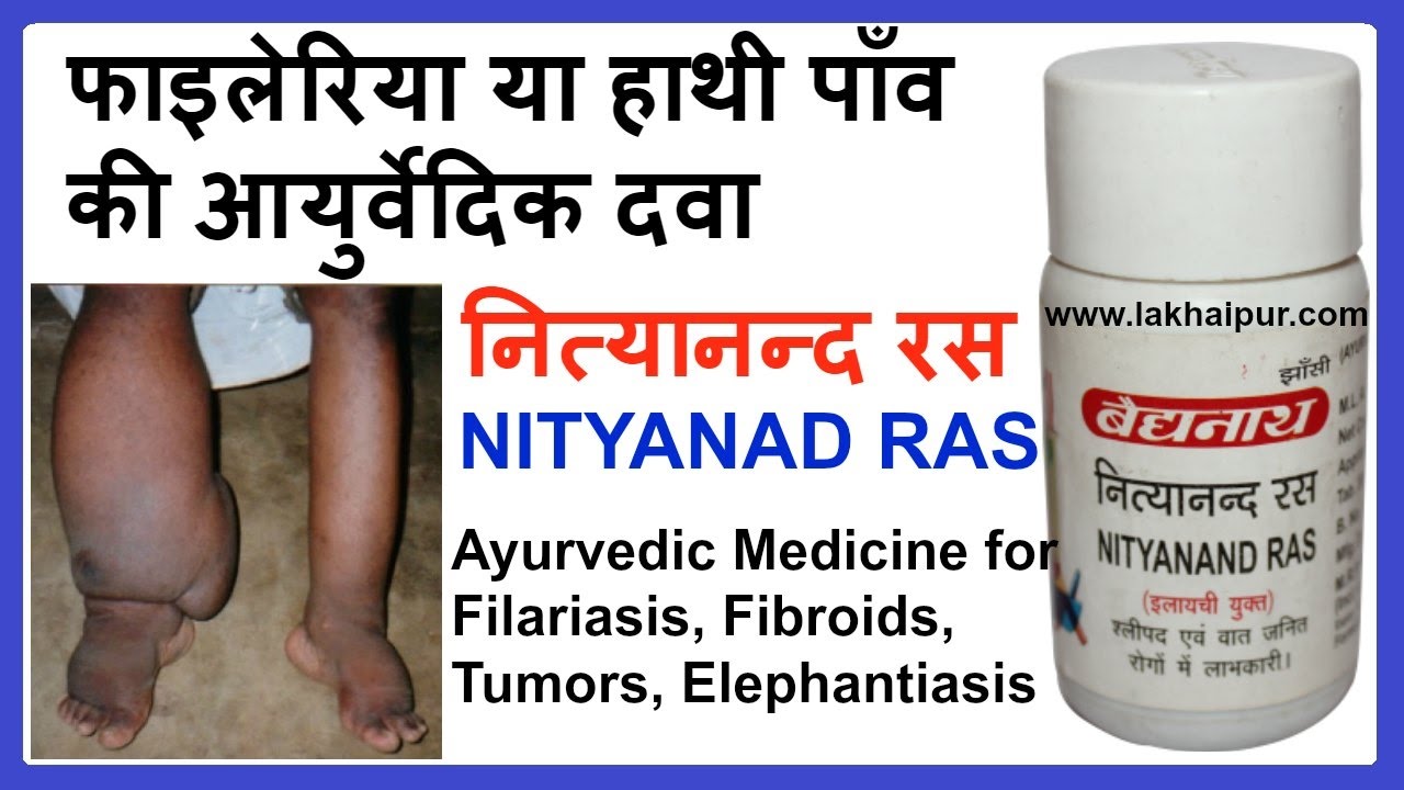 फाइलेरिया या हाथी पाँव की आयुर्वेदिक दवा | Herbal Medicine for ...
