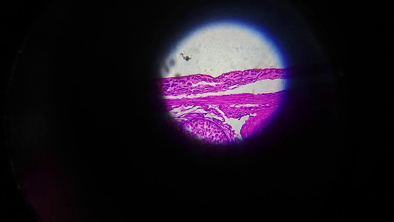 Transverse section of Testis under microscope - YouTube