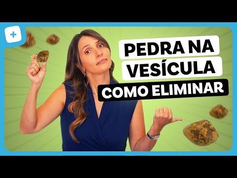 Pedra na vesícula: principais sintomas e alimentação ideal