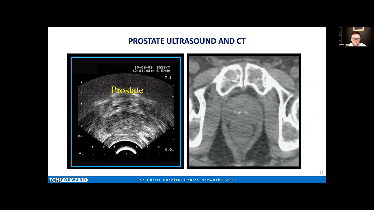 David E. Long, MD a Radiation Oncologist from Christ Hospital Cancer ...