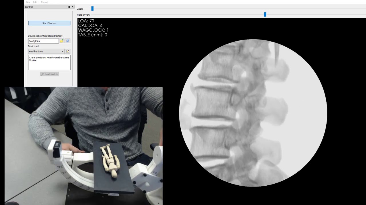 Miniature C-arm Simulator Demo - YouTube