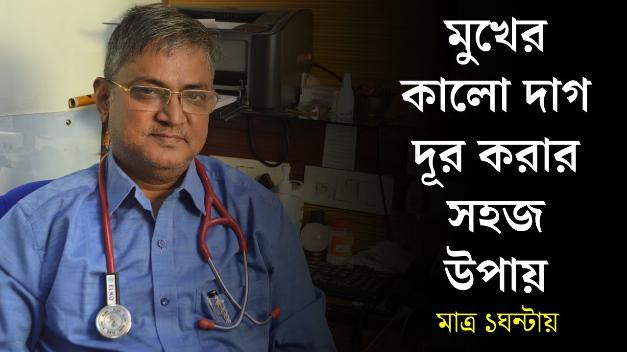 মুখের কালো দাগ দূর করার উপায় - mukher kalo dag tolar upay - মাত্র ১ ...