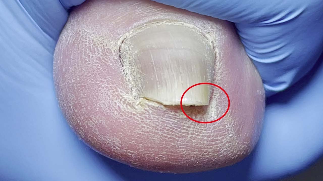 Pedicure Tutorial: Extra Hard Curly Nails! - YouTube