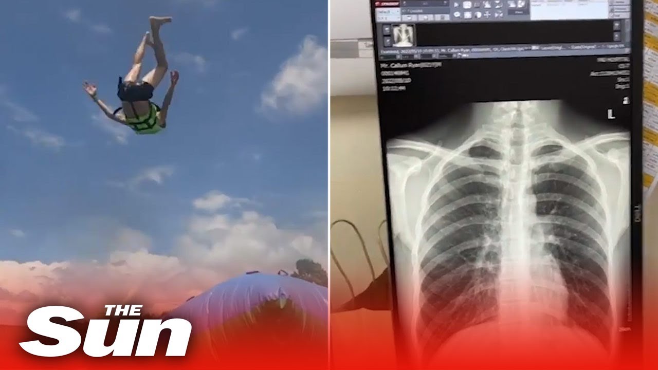 Horror moment man 'punctures lung' after inflatable ride accident # ...