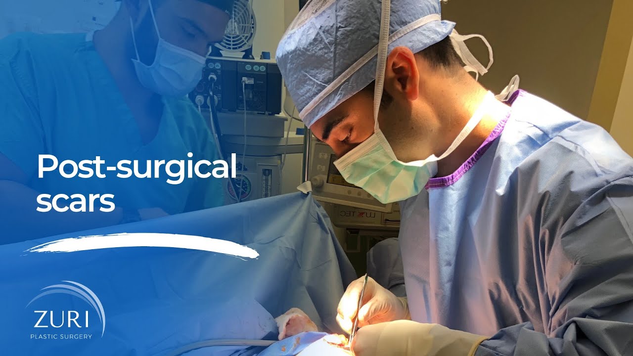 #AskDrZ | Post-surgical scars - YouTube