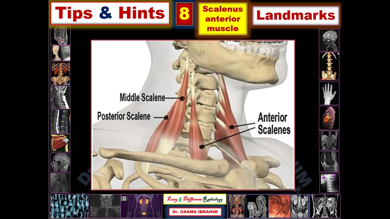 Scalenus anterior muscle landmarks (Tips & Hints 8) - YouTube